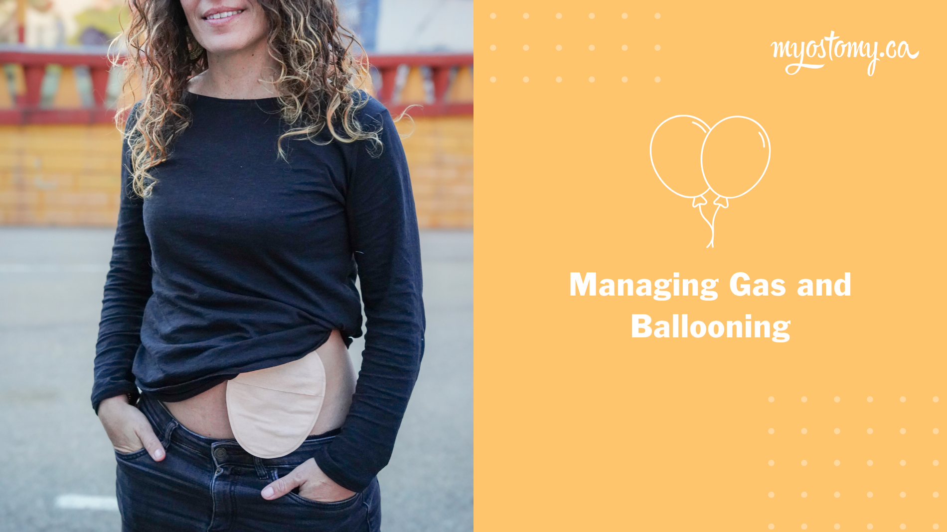 NEW! Say Hello to StomaGenie®: A Better Solution For Ostomy Changes ...