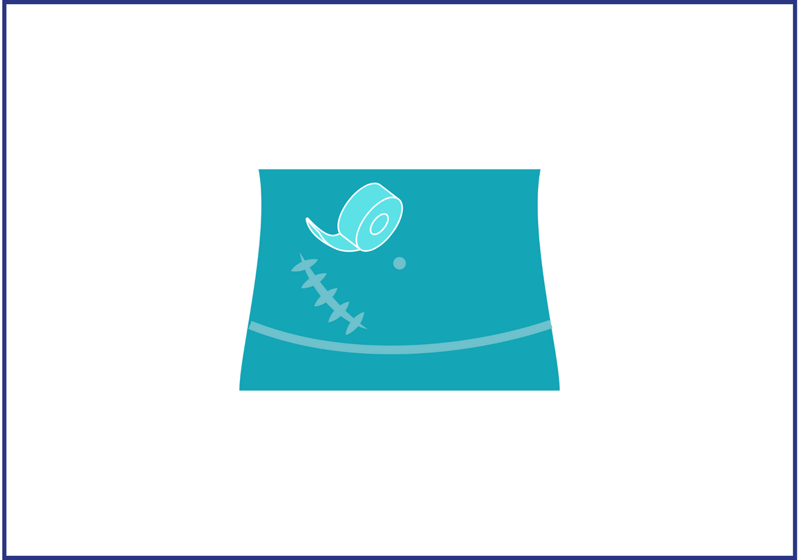 MyOstomy.ca | MyOstomy.ca - Ostomy Product Store